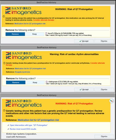 Cds Alert Examples At Bill Henson Blog