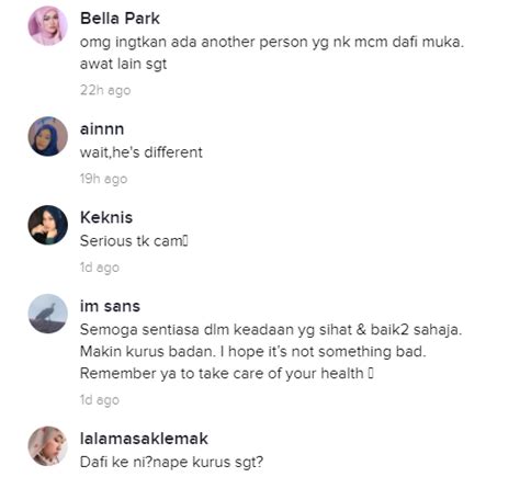 “macam Lain Je Sakit Ke” Video Tiktok Dafi Nampak Kurus Buat Netizen Bimbang Hot Fm