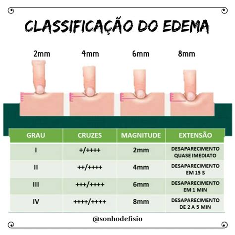 Leg Edema Classification At Donna Fairman Blog