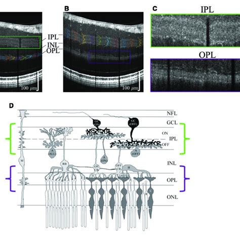 Visualization Of Outer Plexiform Layer Opl Lamination A And Inner Download Scientific