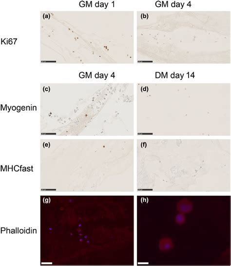 Proliferating Primary Human Myoblast Embedded In 1 Lvg Alginate Gel