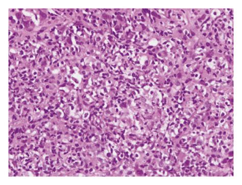 Pathological Findings Original Magnification ×400 Download