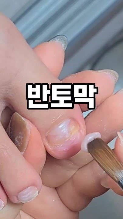 발톱이 없어졌어요🥺 아크릴연장 발톱관리 내성발톱 페디큐어 Youtube
