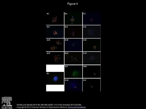 In Vitro Production Of Haploid Cells After Coculture Of Cd49f With