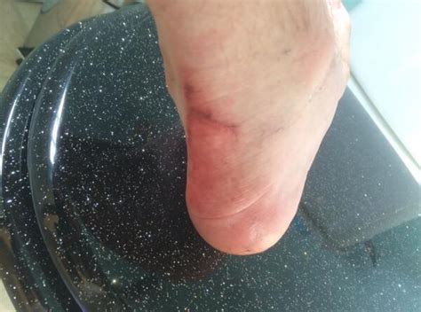 Joel Beanss Feet