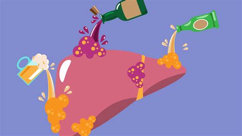 Oms Confirma La Influencia Del Consumo De Alcohol En El Cáncer
