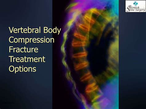 Pdf Vertebral Body Compression Fracture · Fracture Reduction And