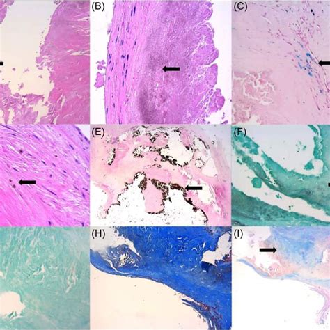 Hematoxylin And Eosin Hande Stain At 10× A And 20× Magnification B