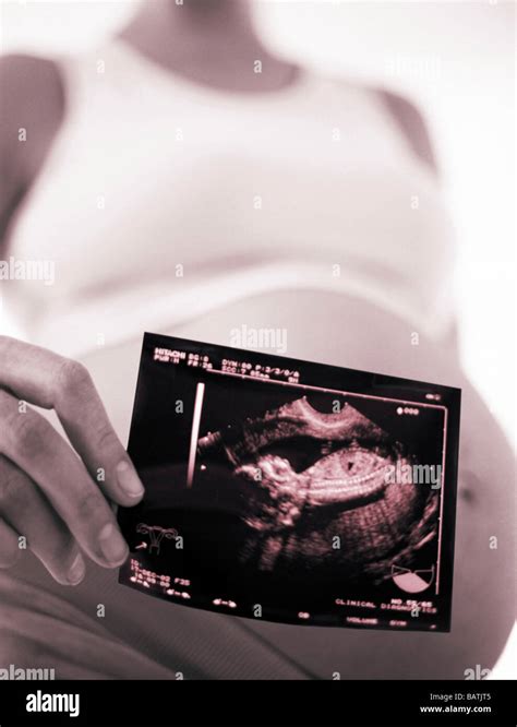Ultrasound Scan Pregnant Woman Holding Anultrasound Scan Of Her Foetus