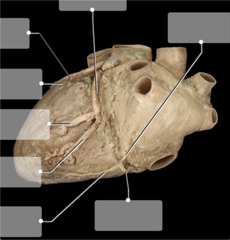 Coronary Arteries On The Posterior Surfaces Of The Heart Diagram Quizlet