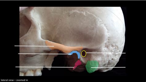 Temporal Bones Part 2 Diagram Quizlet