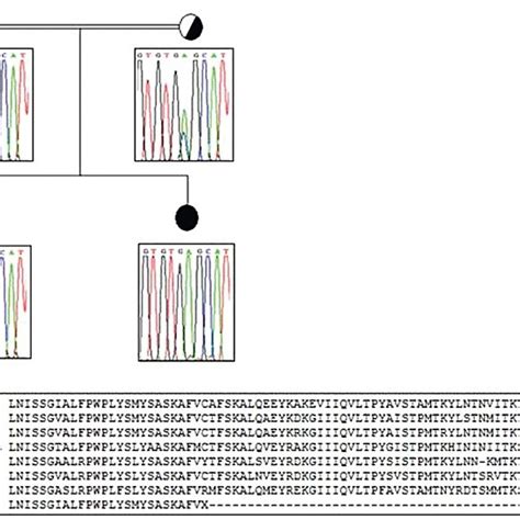 Pdf A Novel Nonsense Mutation In Hsd17b3 Gene In A Tunisian Patient