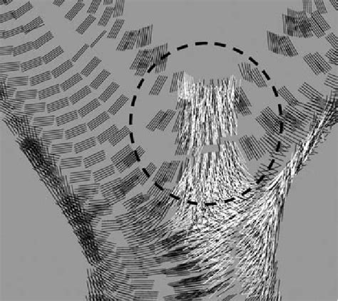 15a Illustrates The Results Of The Described Collagen Remodeling