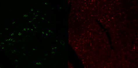 Counting The Colocalization Of Specific Cells Researchgate