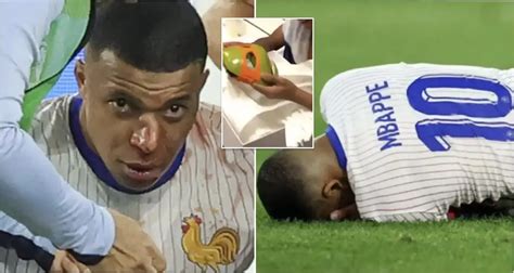 Visto Kylian Mbappé Luce Una Máscara En El Entrenamiento De Francia