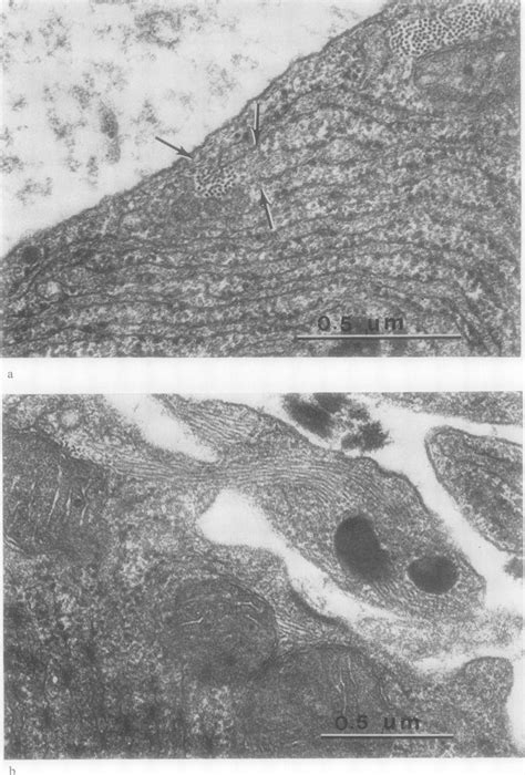 Morphodynamic Appearance Of The Fibrils A Microfibrils And Their Download Scientific Diagram