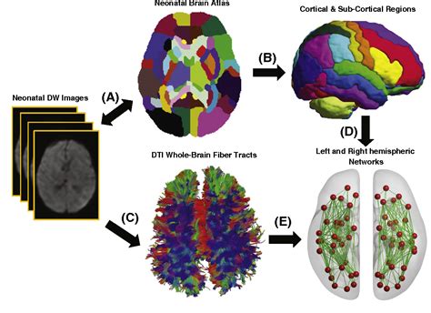 Figure 1 From Structural Connectivity Asymmetry In The Neonatal Brain Semantic Scholar