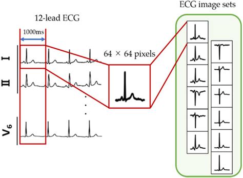 Bioengineering Special Issue Advances Of Biomedical Signal Processing