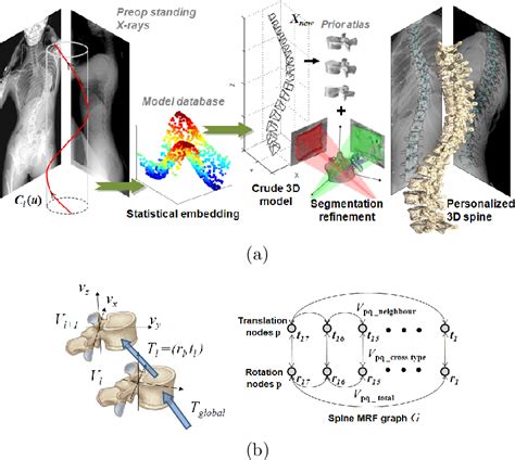 Figure 1 From 3d Registration Of Articulated Spine Models Using Markov