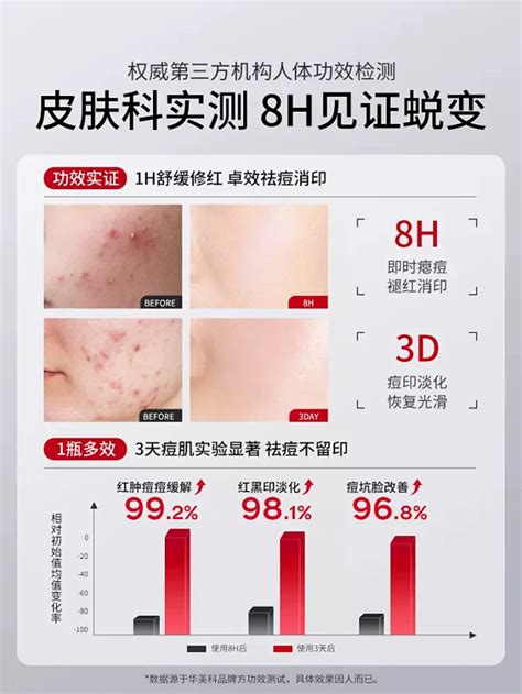 祛痘精华修复淡化痘印痘坑疤男生女水杨酸去闭口粉刺黑头收缩毛孔 天猫 花瓣网