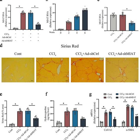 Expression Of Miat In Patients With Cirrhosis A Masson And He Staining
