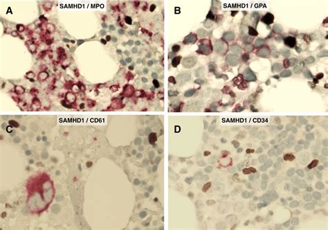 Expression Of Samhd1 Protein In Normal Bone Marrow Double Download