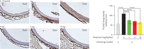 Immunohistochemistry For Angiotensin Ii Type 1 Receptor At1r And