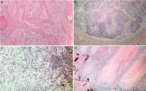 Advances In Anatomic Pathology