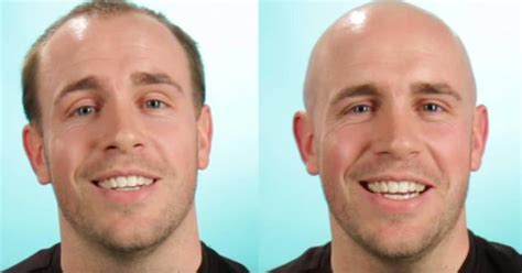 Do These Guys Look Better Bald Girlsaskguys