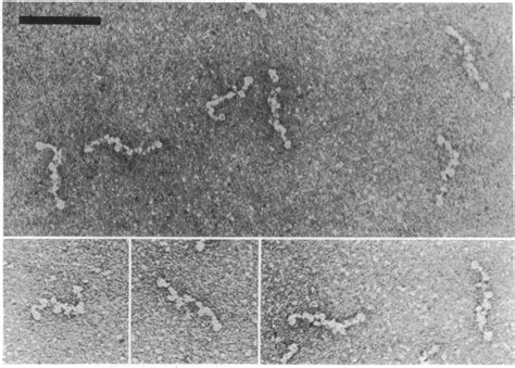 Electron Micrograph Of The Clr Cls Complex Bar Corresponds 50 Nm