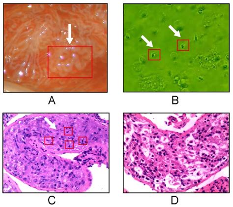 noninvasive prediction of sperm retrieval using diffusion tensor