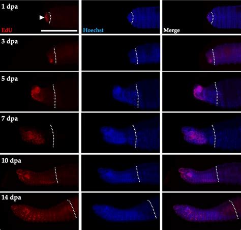 Active Cell Proliferation In Regeneration A The Schematic Cartoon