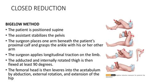 Hip Dislocation Anatomy History Diagnosis Treatment And Management Pptx