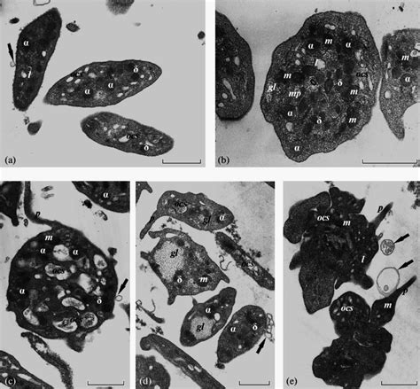 A B Ultrastructure Of Resting Platelets And Platelets Activated By