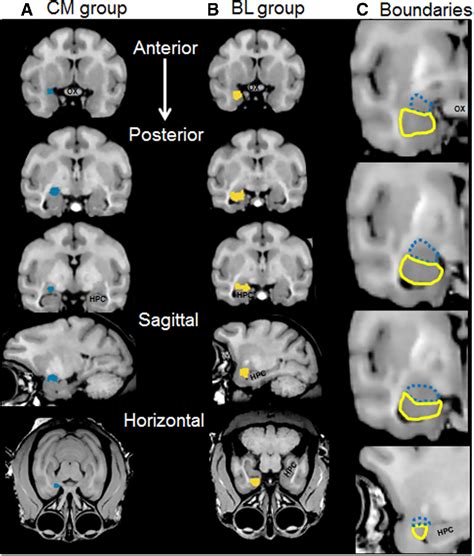 Figure 3 From Orbitofrontal Cortex Volume In Area 1113 Predicts Reward