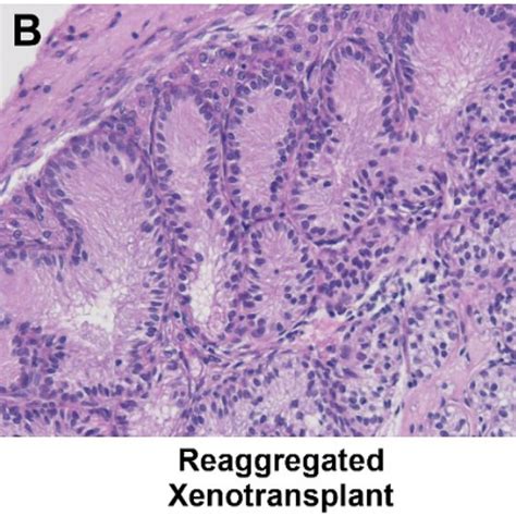 Re Aggregated Fetal Rat Testis Xenotransplants Form Seminiferous Download Scientific Diagram