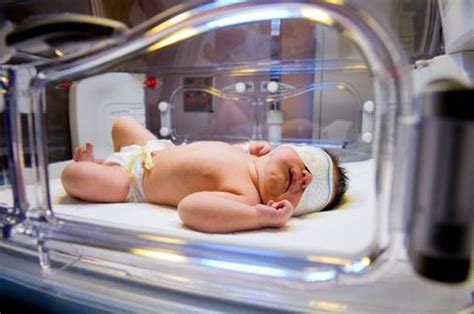 O Que é Icterícia Neonatal Mega Curioso