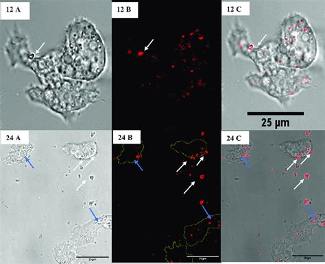 CLSM Bright Field A Fluorescent B And Composite C Images Of