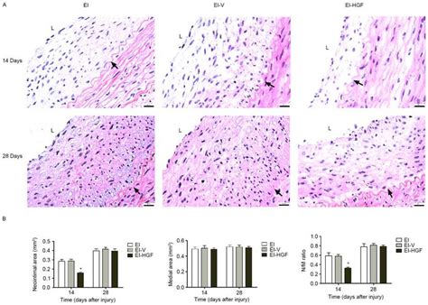 Effect Of In Vivo Hhgf Transfection On Neointima Formation At 14 And 28