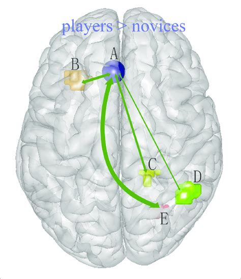 Enhanced Functional Connections Between Left Medial Frontal Cortex