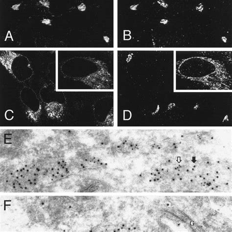 Subcellular Distribution Of Native B Subunit Of Shiga Like Toxin Vt1b