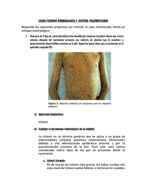 Casos Clínicos Embriología I JOSUE FELIPE FERNANDEZ ESCOBAL uDocz