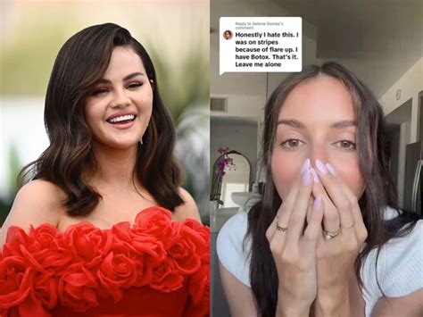 Selena Gomez Addresses Cosmetic Surgery Speculation ‘leave Me Alone