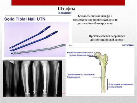 Введение в травматологию презентация онлайн