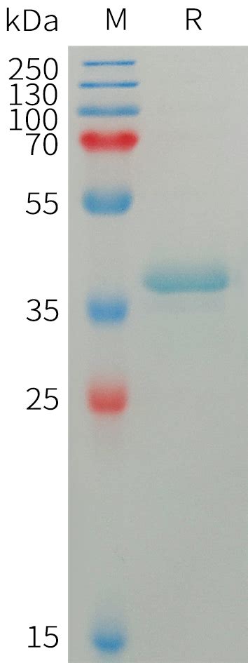 Human S100a4 Protein Hfc Tag Dima Biotechnology