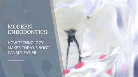 3d Imaging Root Canal Archives Eastern Idaho Endodontics