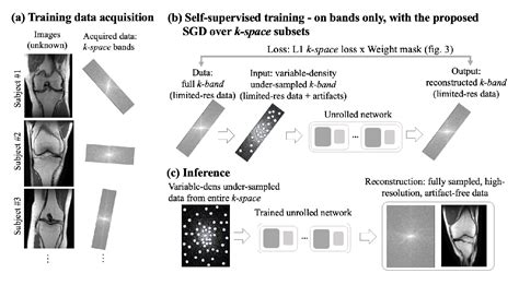 figure 1 from k band self supervised mri reconstruction trained only