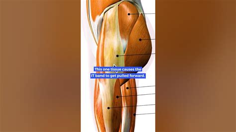 Most Common Cause Of Knee Pain Youtube