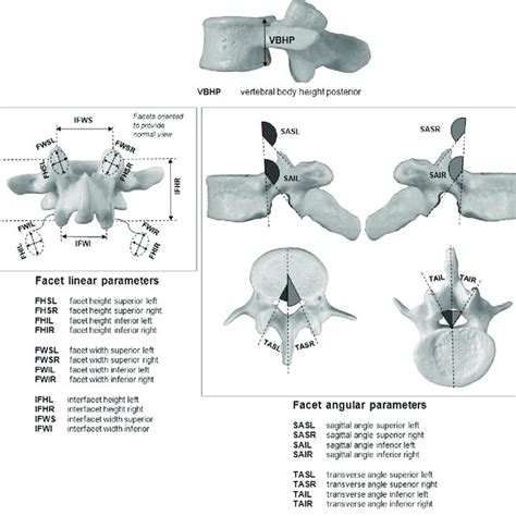 Schematic Representation Of The Anatomical Parameters That Were Download Scientific Diagram