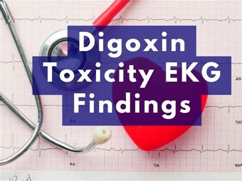 Digoxin Toxicity Ekg Findings For Early Treatment A Practical Guide In 2023